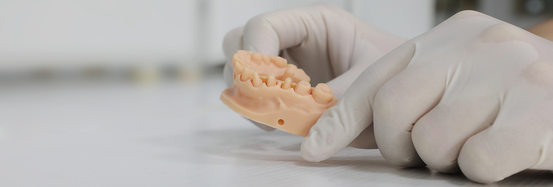 Choosing the Right 3D Printing Technology for Dental Work: DLP vs SLA ...